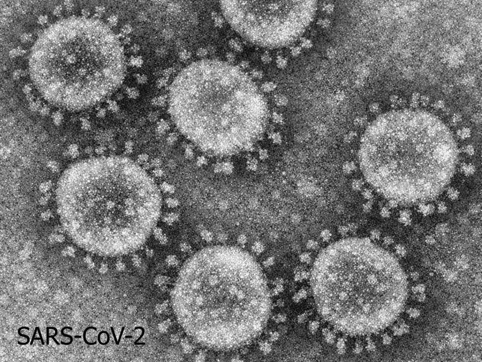 新規ピリドンカルボン酸誘導体の「抗SARS-CoV-2薬」に関する発明について国際特許出願を行いました - 鹿児島大学先端科学研究推進センター ...